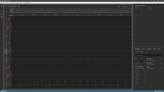 Videos | ADInstruments
