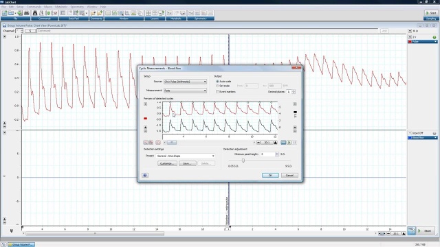LabChart | ADInstruments