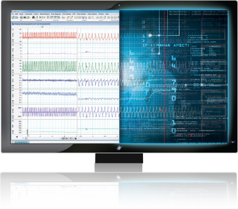 Langendorff Isolated Heart Perfusion Technique | ADInstruments