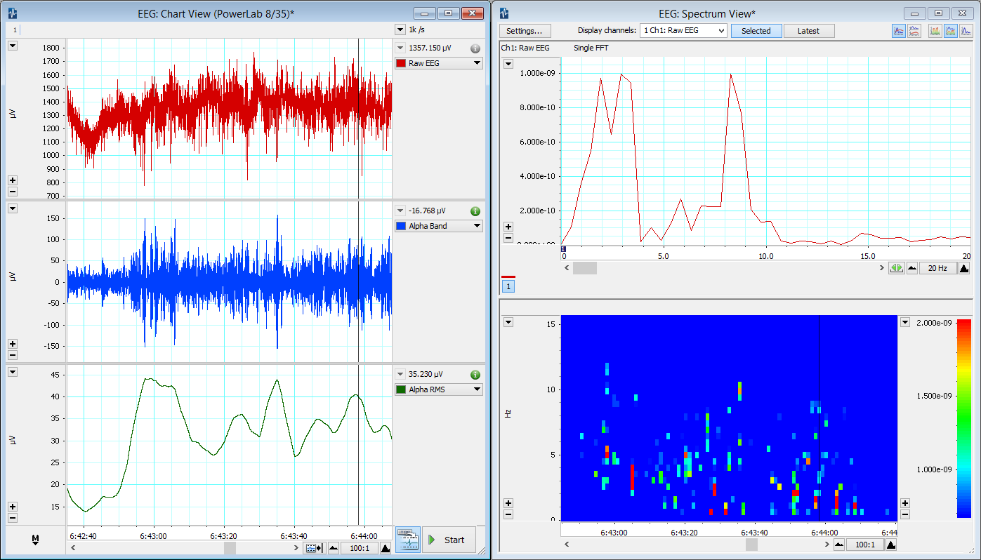 Electroencephalography (EEG) Analysis & Measurement | ADI