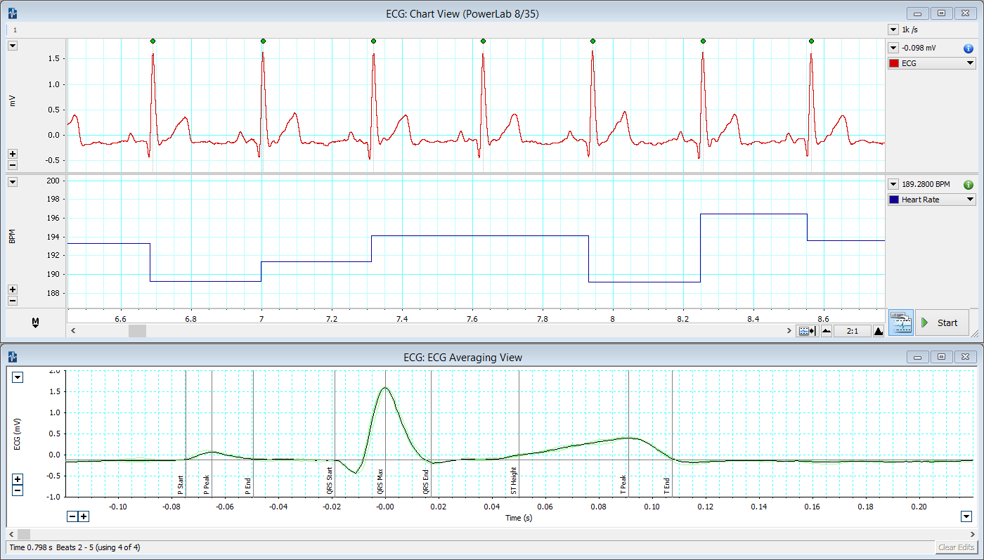 ECG Signal | Powerlab ECG Studies for Human & Animal Physiology | ADI