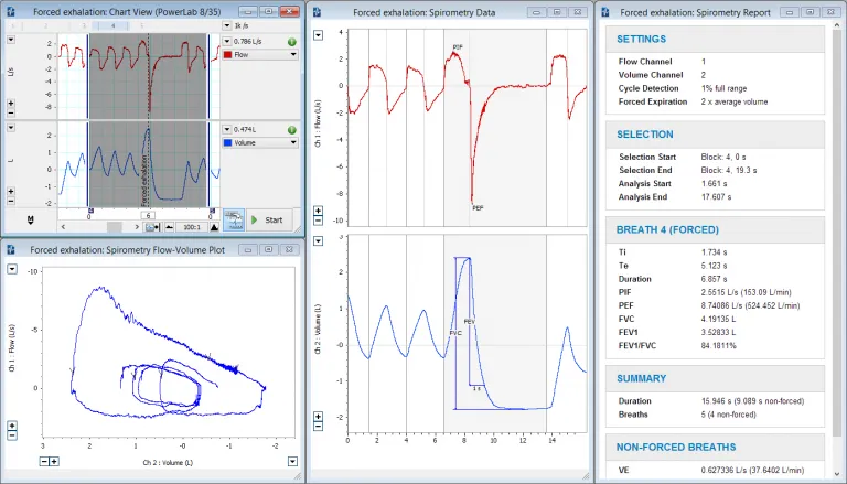 Spirometry | Respiratory and lung function testing | ADInstruments