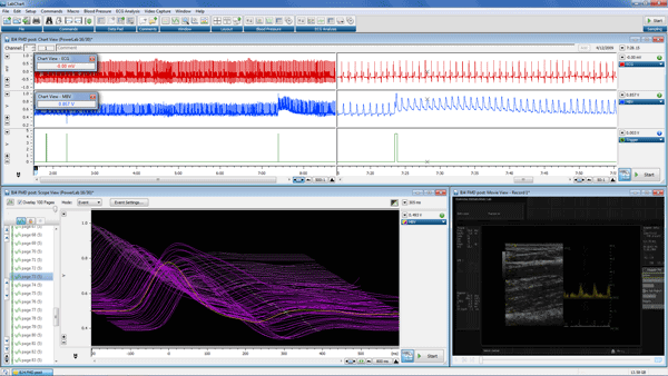 Are we exercising enough? PowerLab used in weight and cardiovascular ...